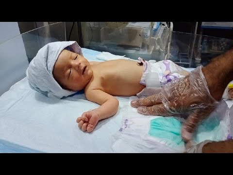 How to Change a Diaper in the NICU | Step-by-Step Newborn Care Guide# ...