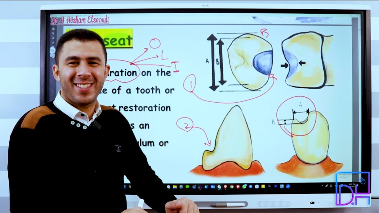 Rest and Rest Seat in Removable Partial Denture - YouTube