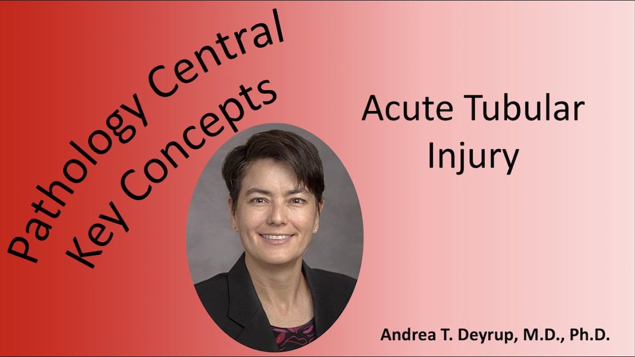 Medical School Pathology: Pathophysiology of Acute Tubular Injury - YouTube