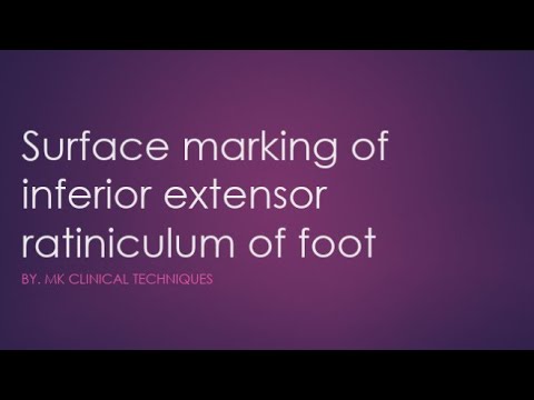 Inferior extensor retinaculum of foot|| surface marking of inferior ...