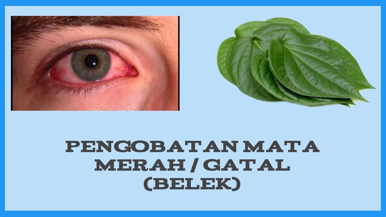 OBAT HERBAL Mata Merah, Pegal & Gatal ( BELEK ) - YouTube