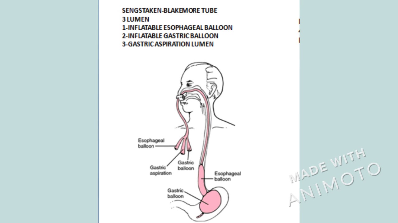 GASTROINTESTINAL TUBES - YouTube
