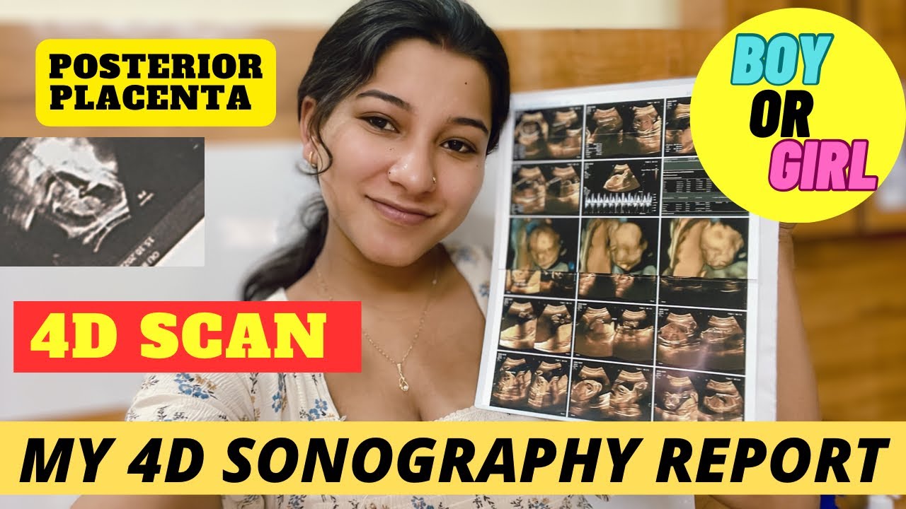 MY 4D SONOGRAPHY REPORT || Anomaly scan report || 4d scan report # ...