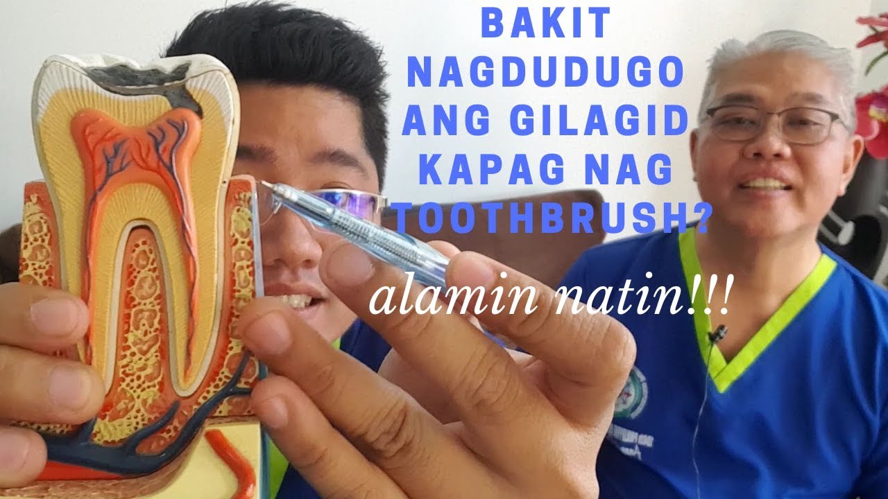 bakit dumudugo ang gilagid pag nag toothbrush? Periodontitis and ...