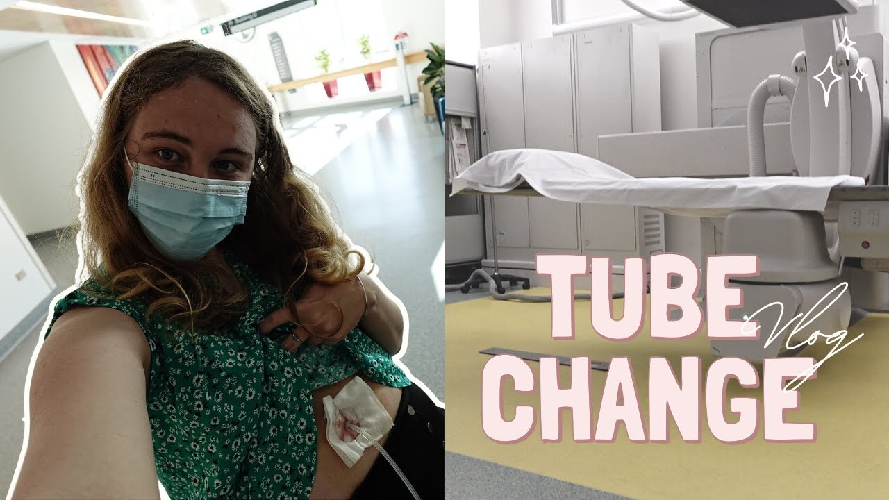 Finally Getting my Feeding Tube Change GASTROPARESIS HOSPITAL VLOG ...