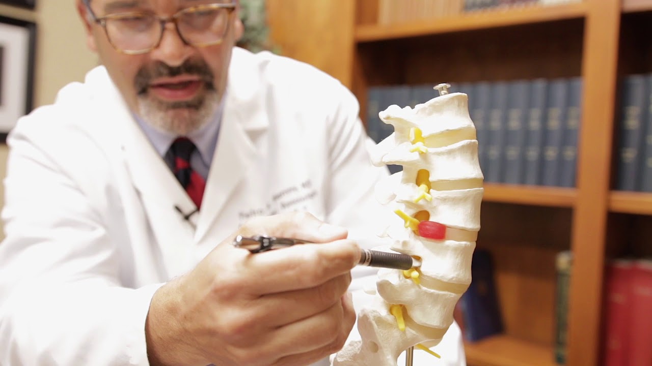 Dr. Pietro Memmo - Sciatica & Spinal Stenosis - YouTube