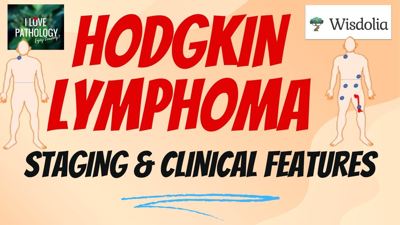 HODGKIN LYMPHOMA | Staging| Clinical Features | Treatment| Prognosis ...