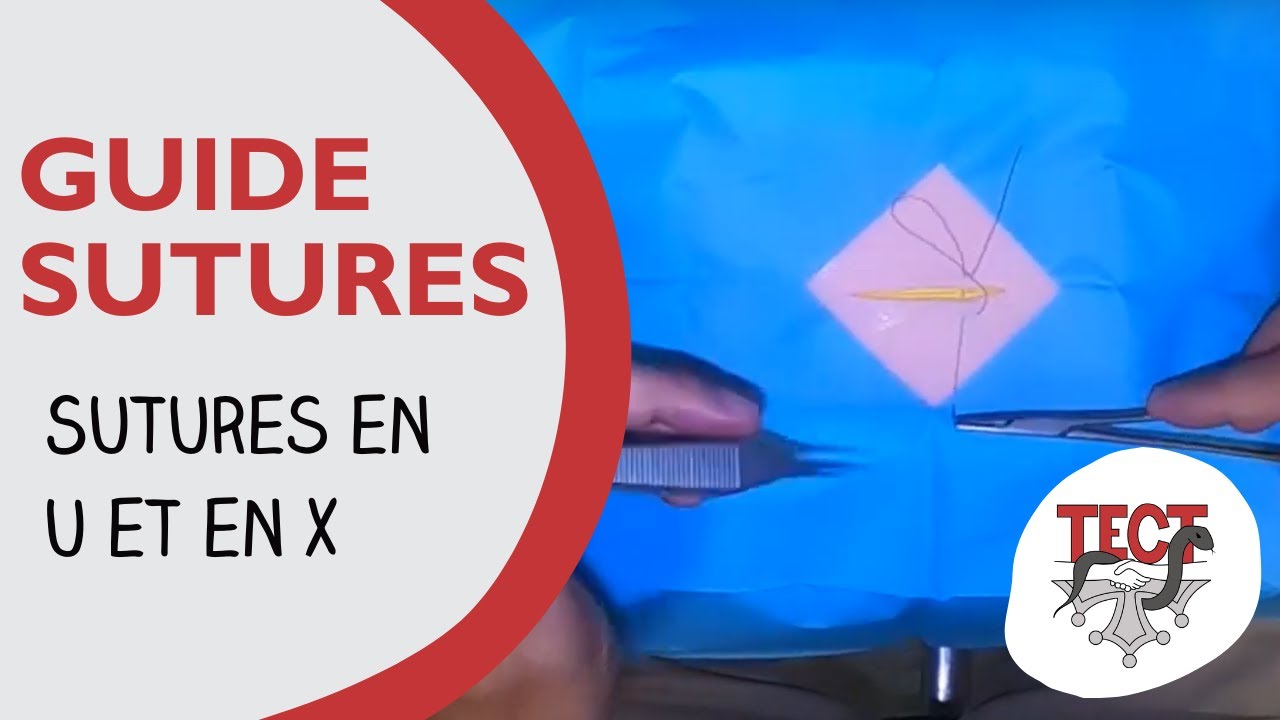 Guide suture | Sutures en U et en X - YouTube