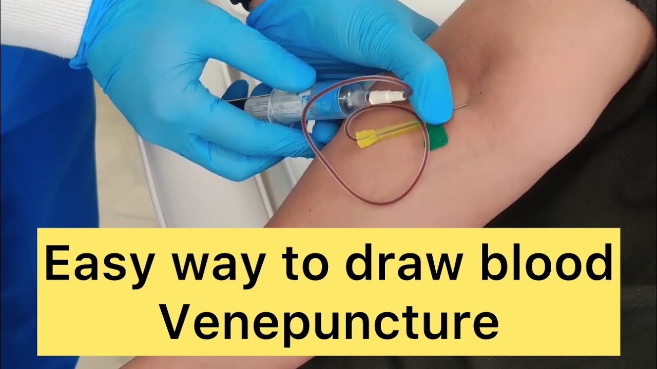 How to draw blood. Venepuncture. Blood sample for PRP Platelet rich ...