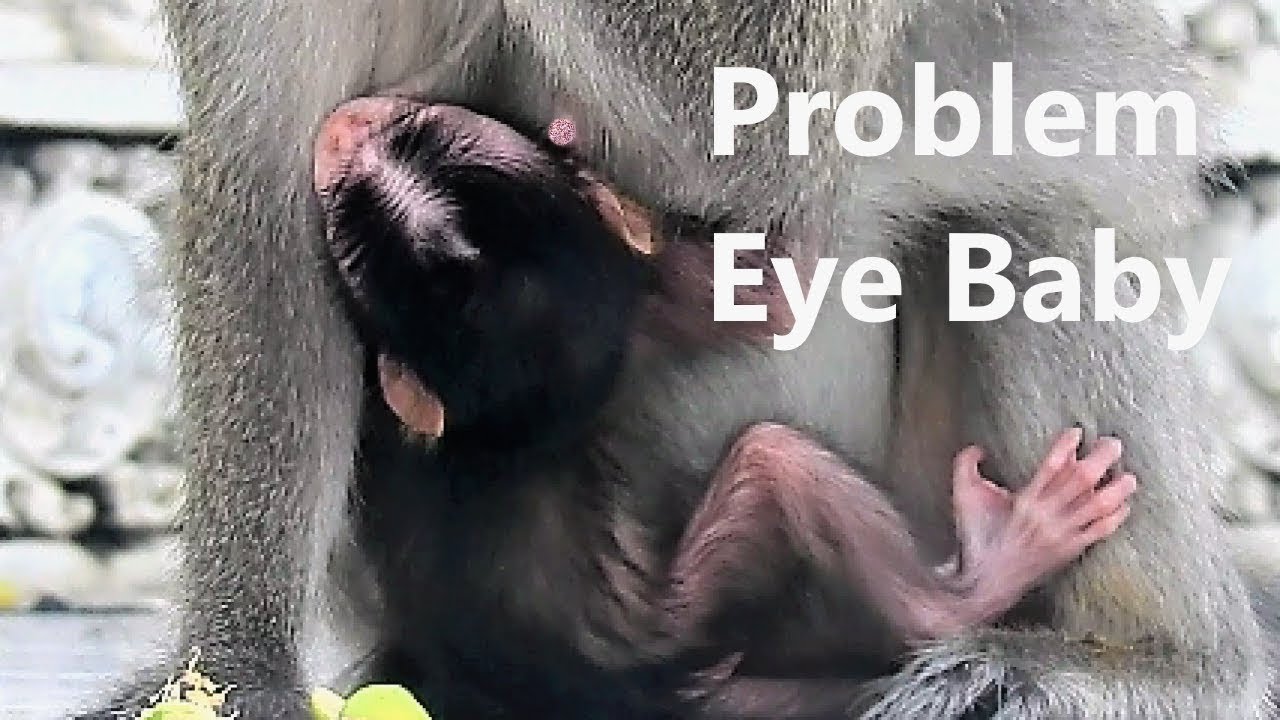 It is So Pity of Eye Problem Baby, She May Faces Can Not See the World ...