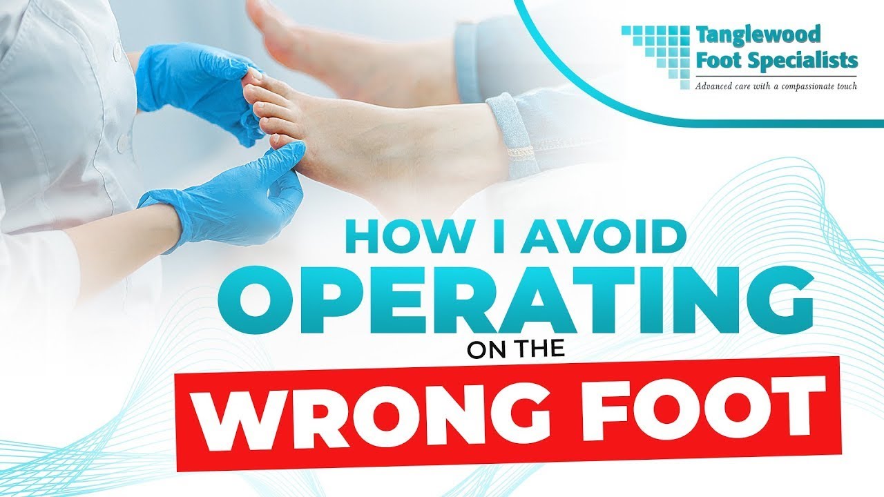 Preventing Surgical Errors: Expert Advice to Avoid Operating on the ...