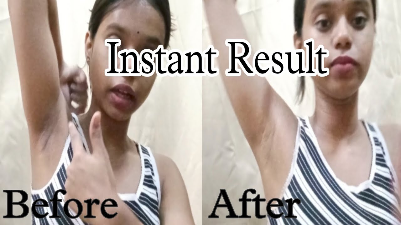 Instant home remedy/Bright your underarm in just 3 steps || 100% result ...