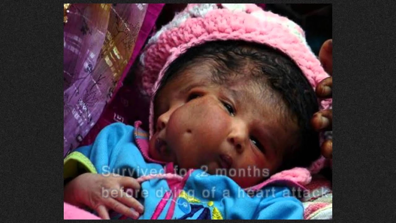 Born with two faces - YouTube
