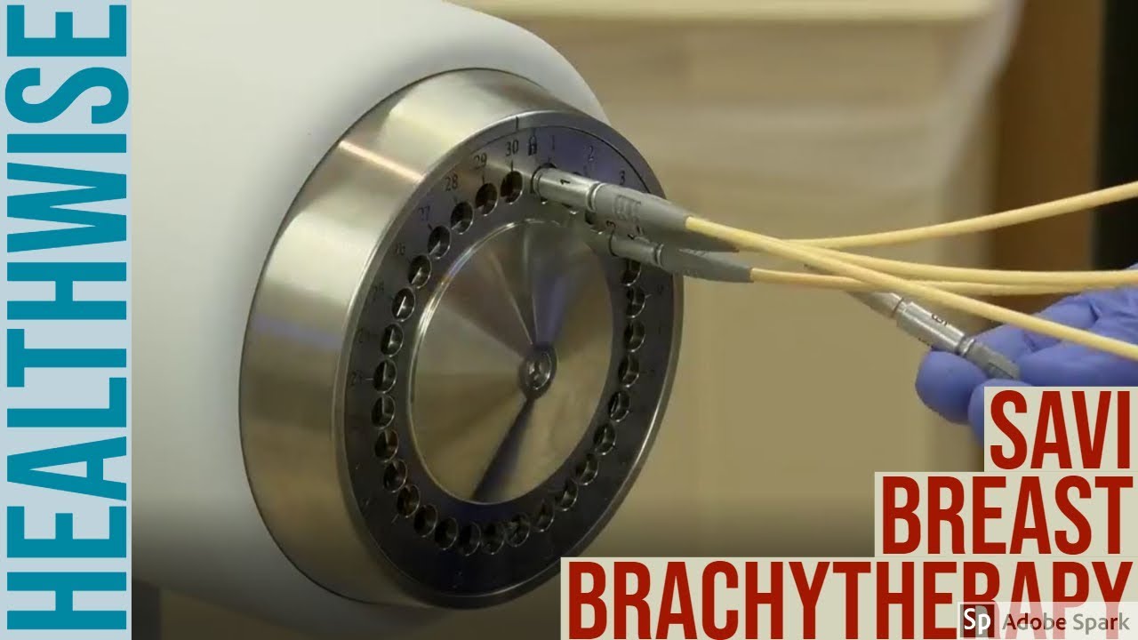 SAVI Breast Brachytherapy - YouTube