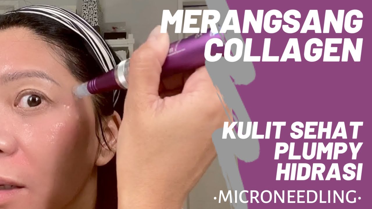 MICRONEEDLING Part 2 - Step by Step proses Microneedling - YouTube