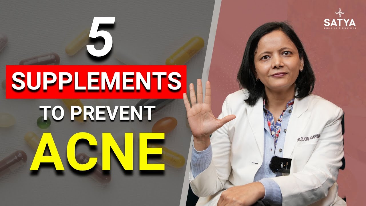Top 5 Supplements to Prevent Acne | How to get rid of Acne | Acne ...