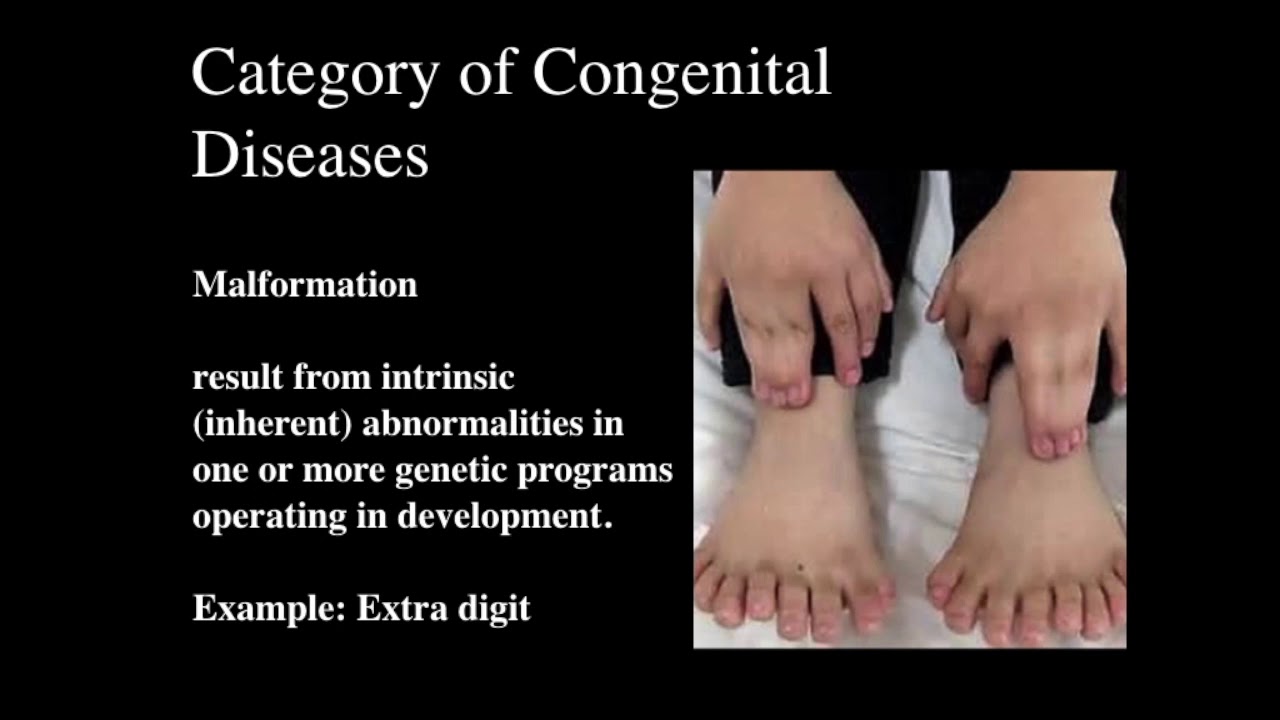 Congenital Limb Deformity Types – RDGG