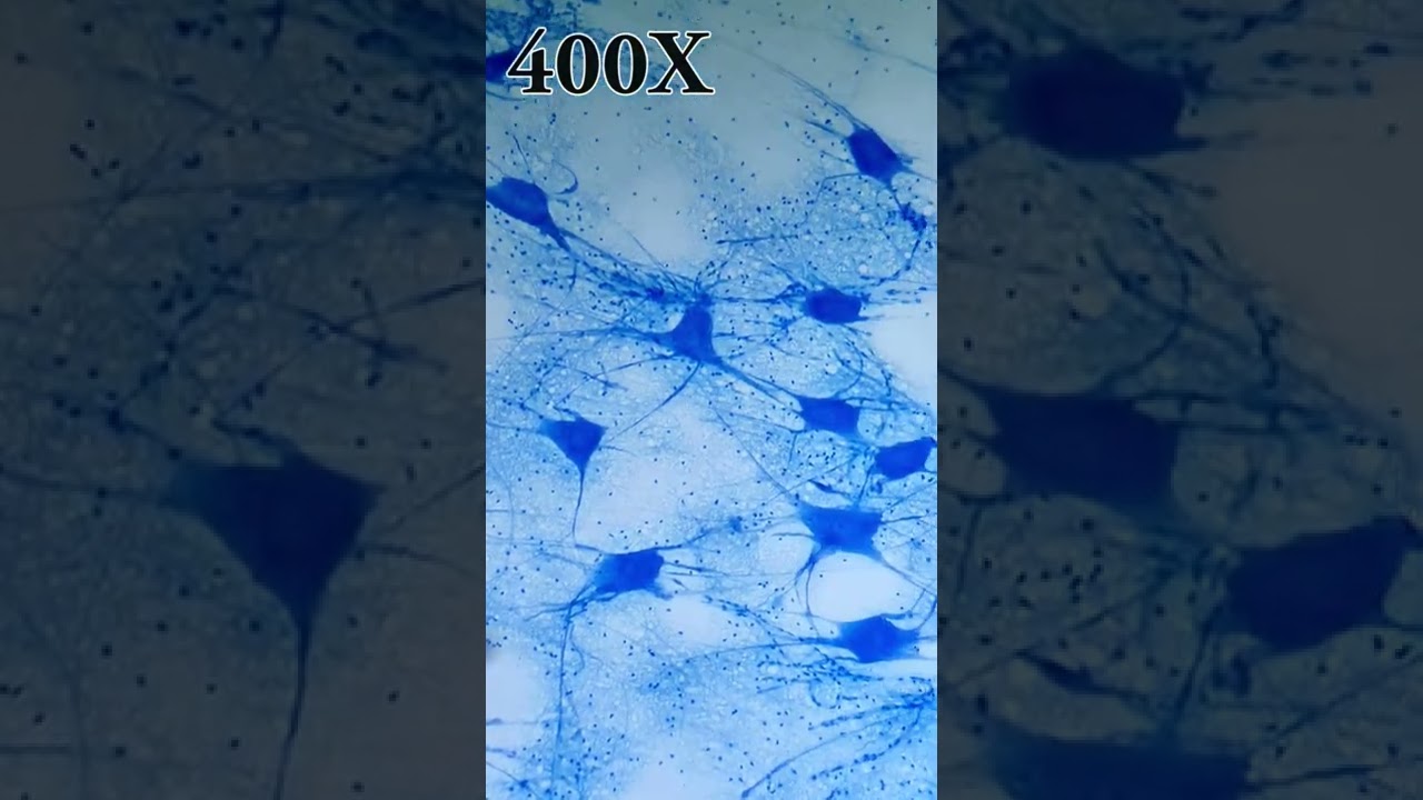 NEURONAS BAJO EL MICROSCOPIO🧠🔬 - YouTube
