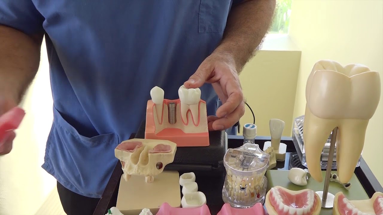Dental Implants Stage 2 treatment (explained) - YouTube