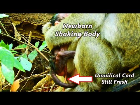 Newborn Shaking Body Super Hug Mom & Fresh Umbilical Cord Fall Down ...