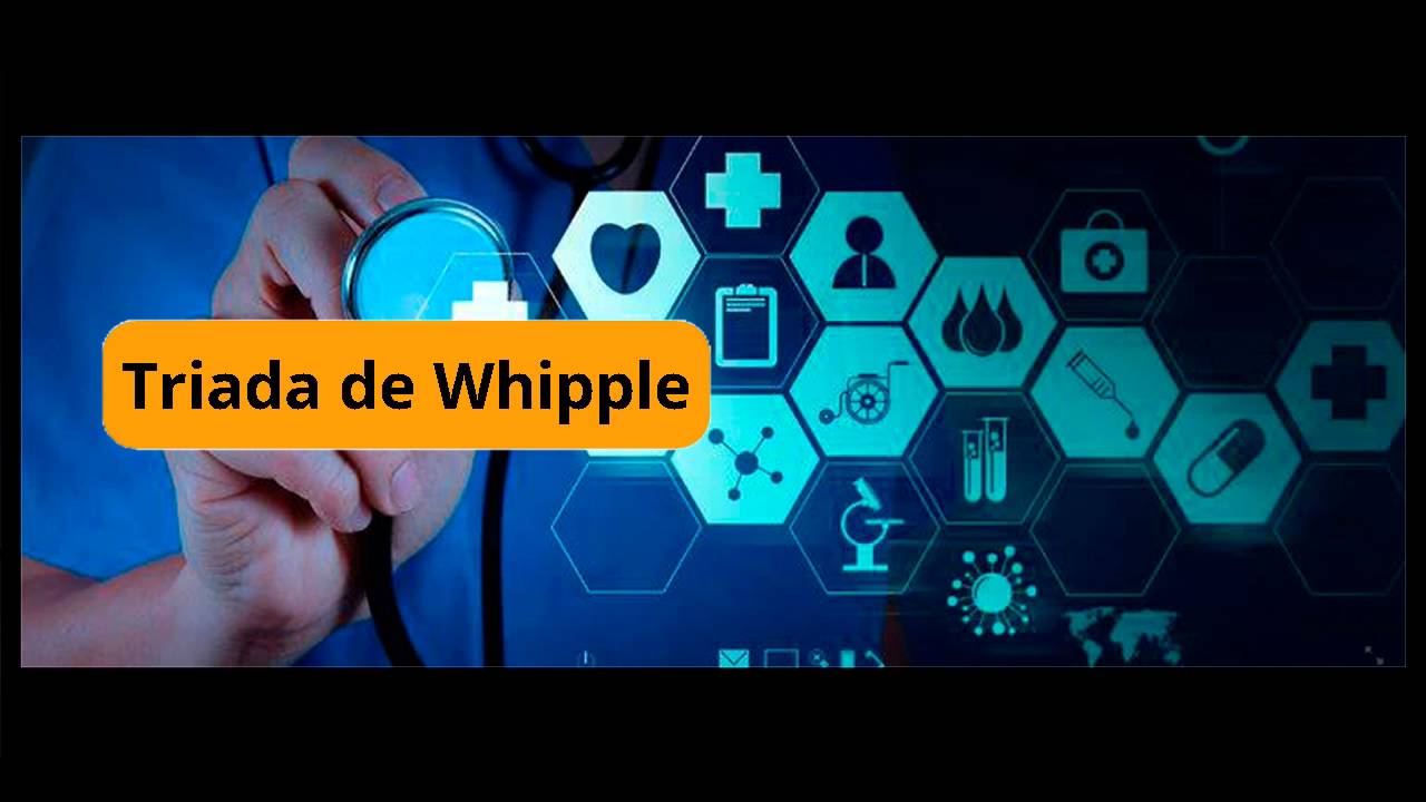 Triada de Wipple | Whipple's triad - YouTube