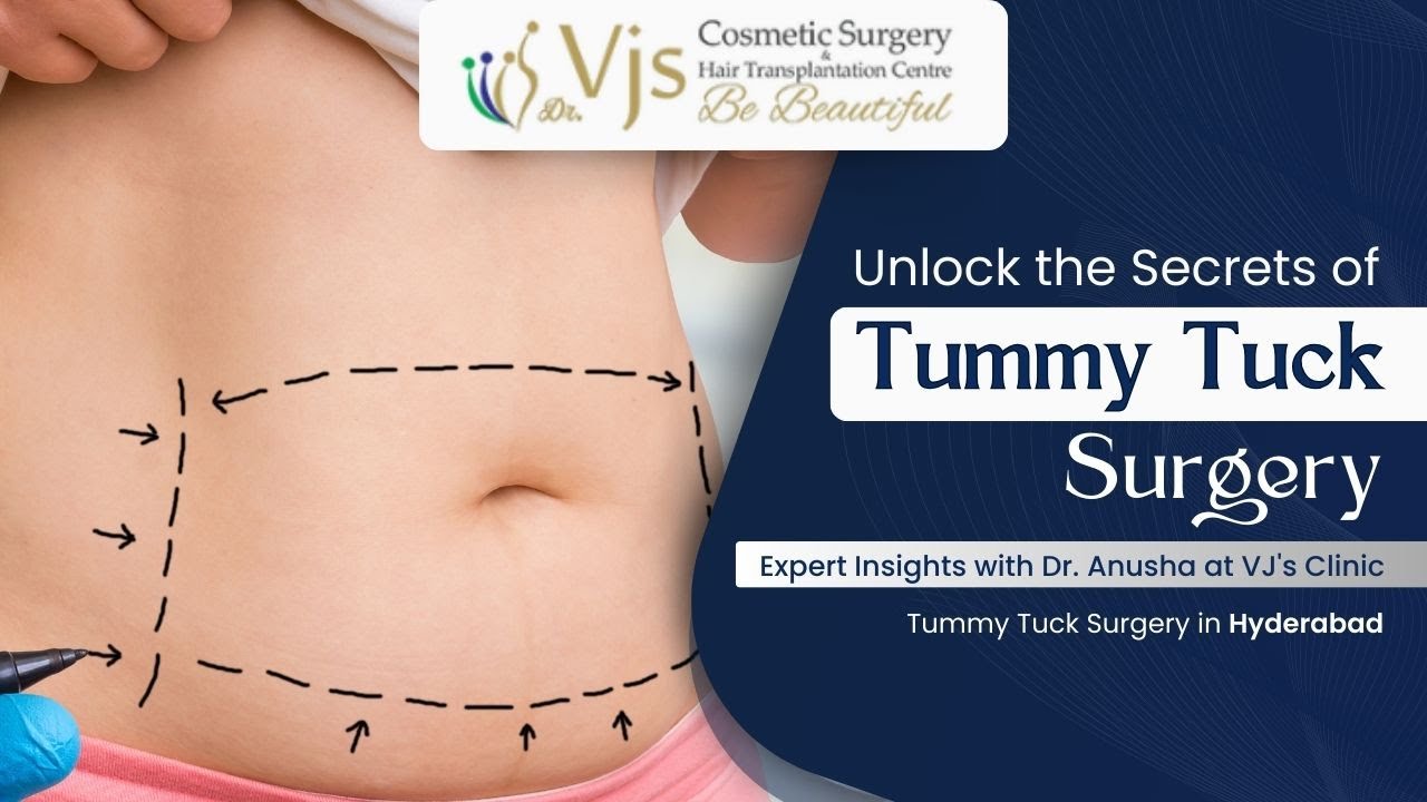 Unlock the Secrets of Tummy Tuck Surgery at VJ's Clinic | tummy tuck ...