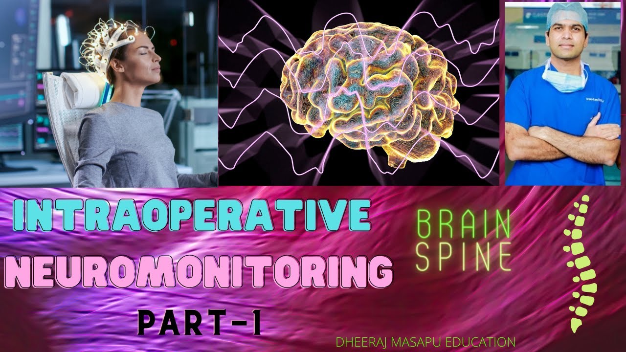 Intraoperative neuromonitoring in Brain and Spine surgery - YouTube