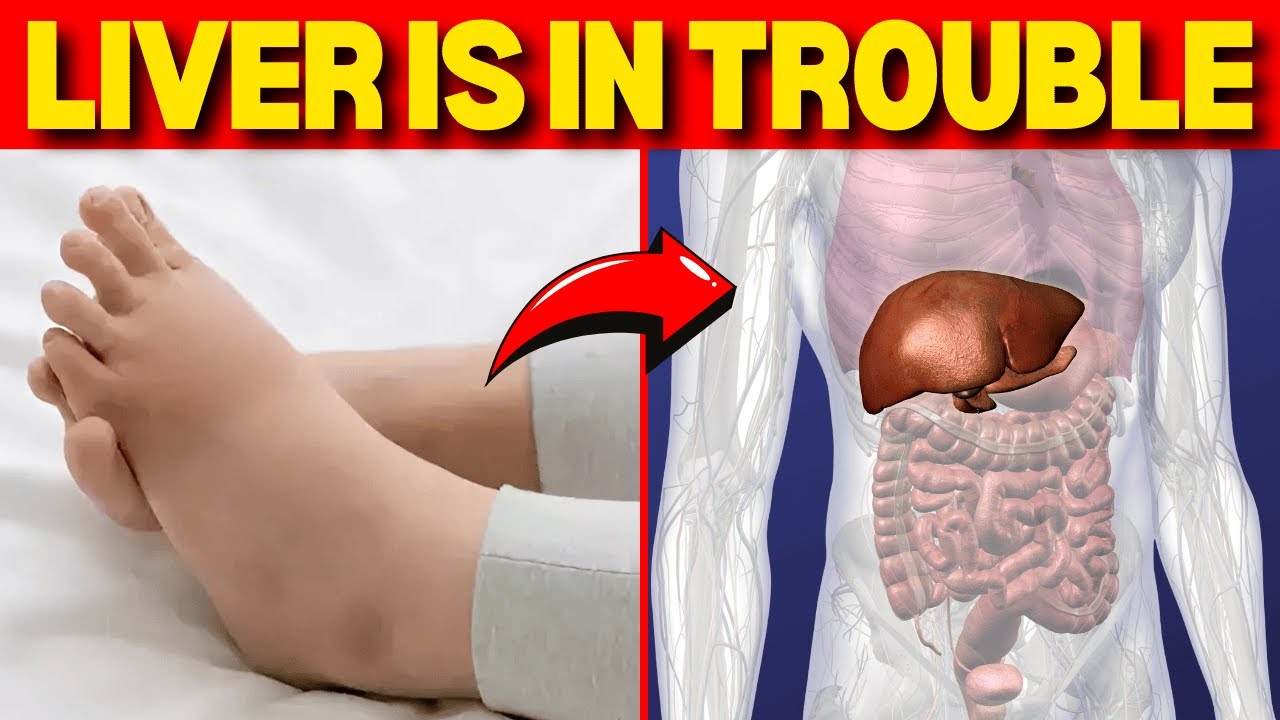 9 Ways Your Feet Are Telling You That Your Liver Is In Trouble - YouTube