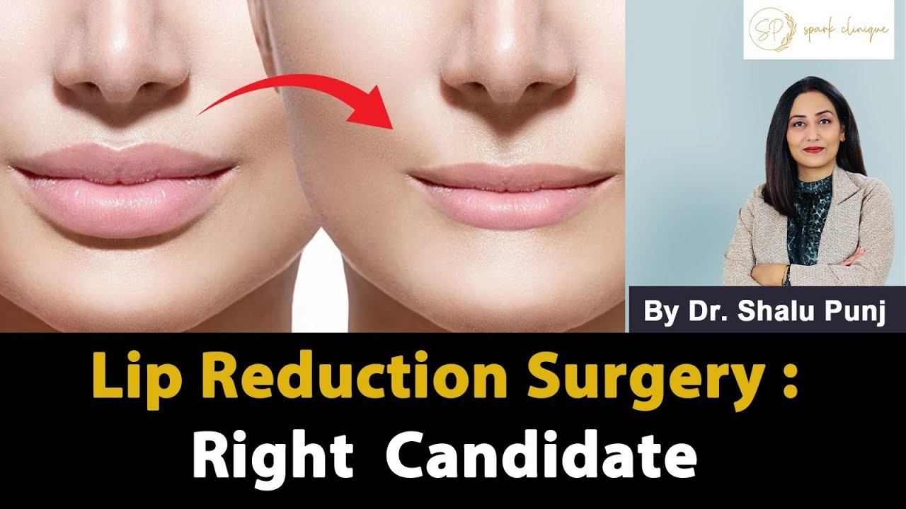 Lip 👄 Reduction Surgery | Dr. Shalu punj - Plastic Surgeon India - YouTube