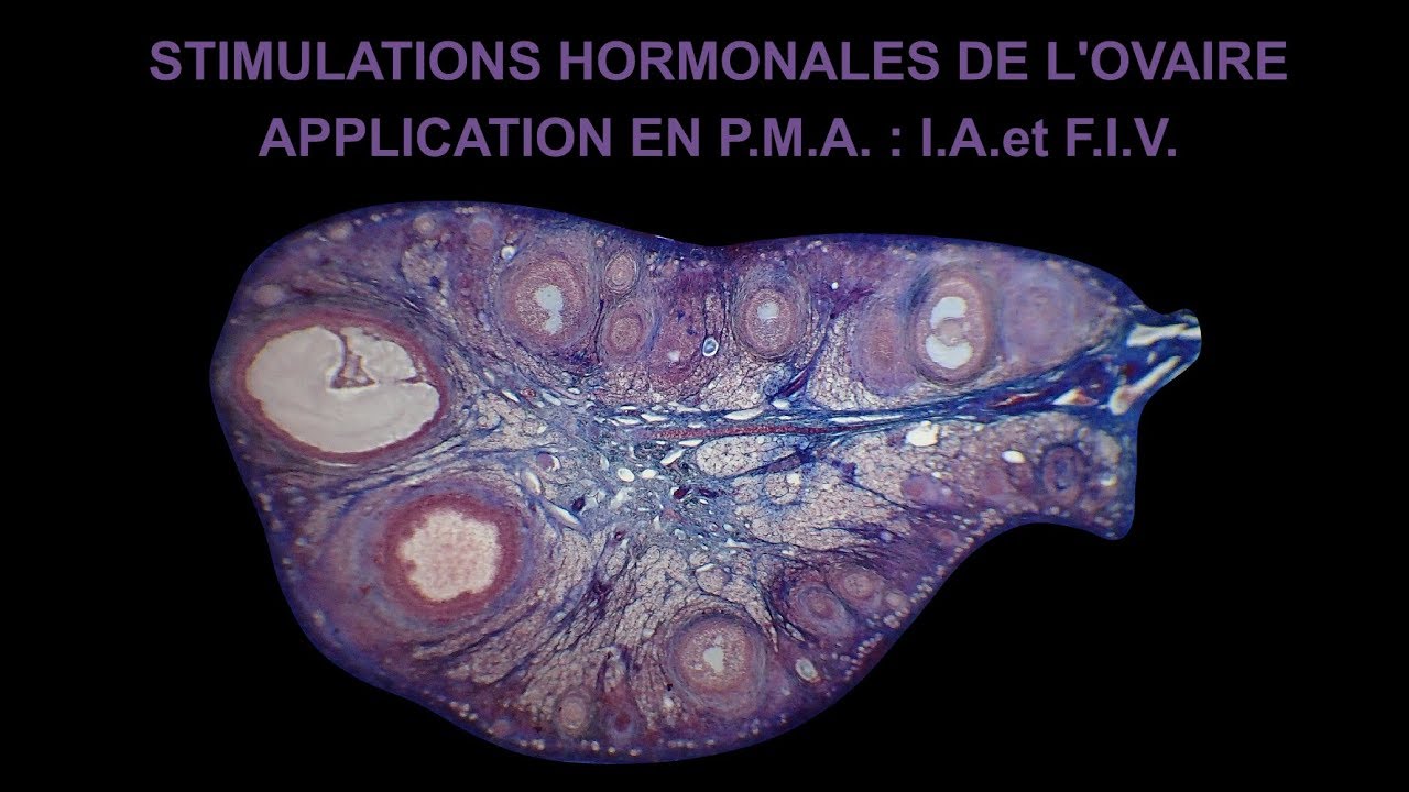 # PMA - Stimulation hormonale ovarienne en PMA avant IA ou FIV - YouTube