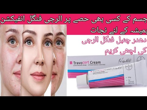 Travocort Cream benefit Uses in Urdu | Best cream for fungal Infection ...