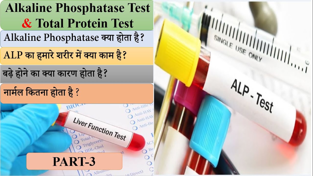Alkaline Phosphatase Test | ALP Test | Total Protein Test | Albumin I ...