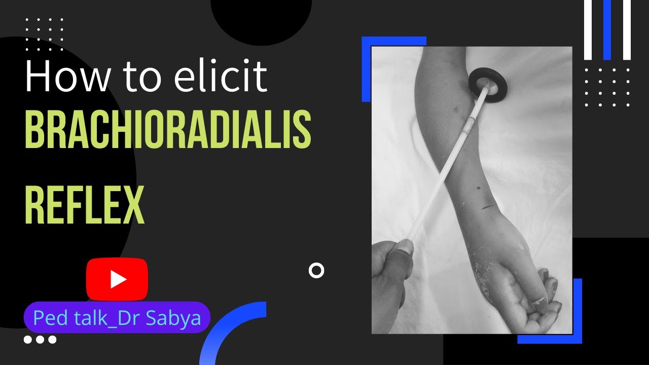 Brachioradialis Reflex Brachioradialis Muscle Fotos Und Bildmaterial