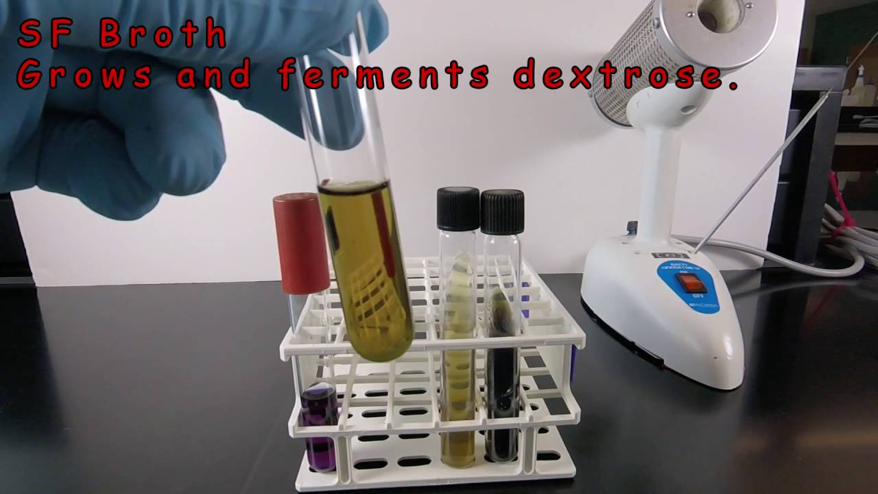 Using SF Broth and Bile Esculin Agar to Identify Enterococcus - YouTube