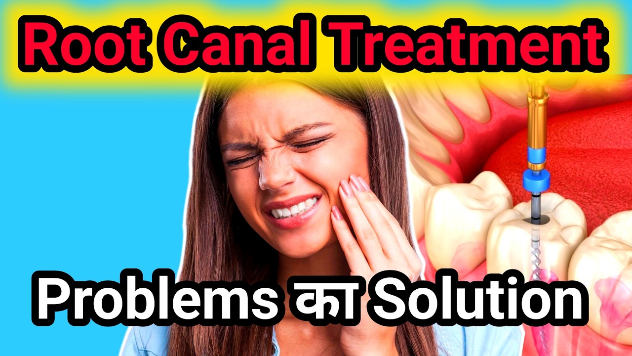 Why Root Canal Treatment Fails | 5 Shocking Root Canal Treatment ...