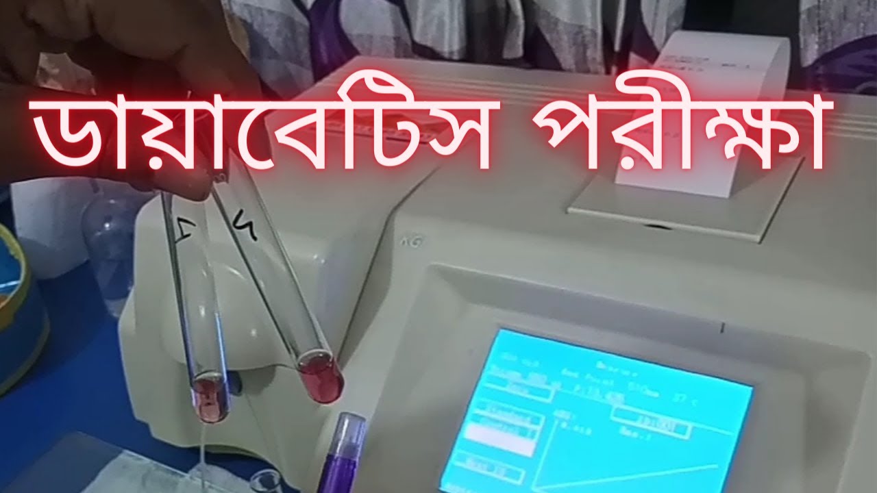 rbs test | sugar test | random blood sugar level - YouTube