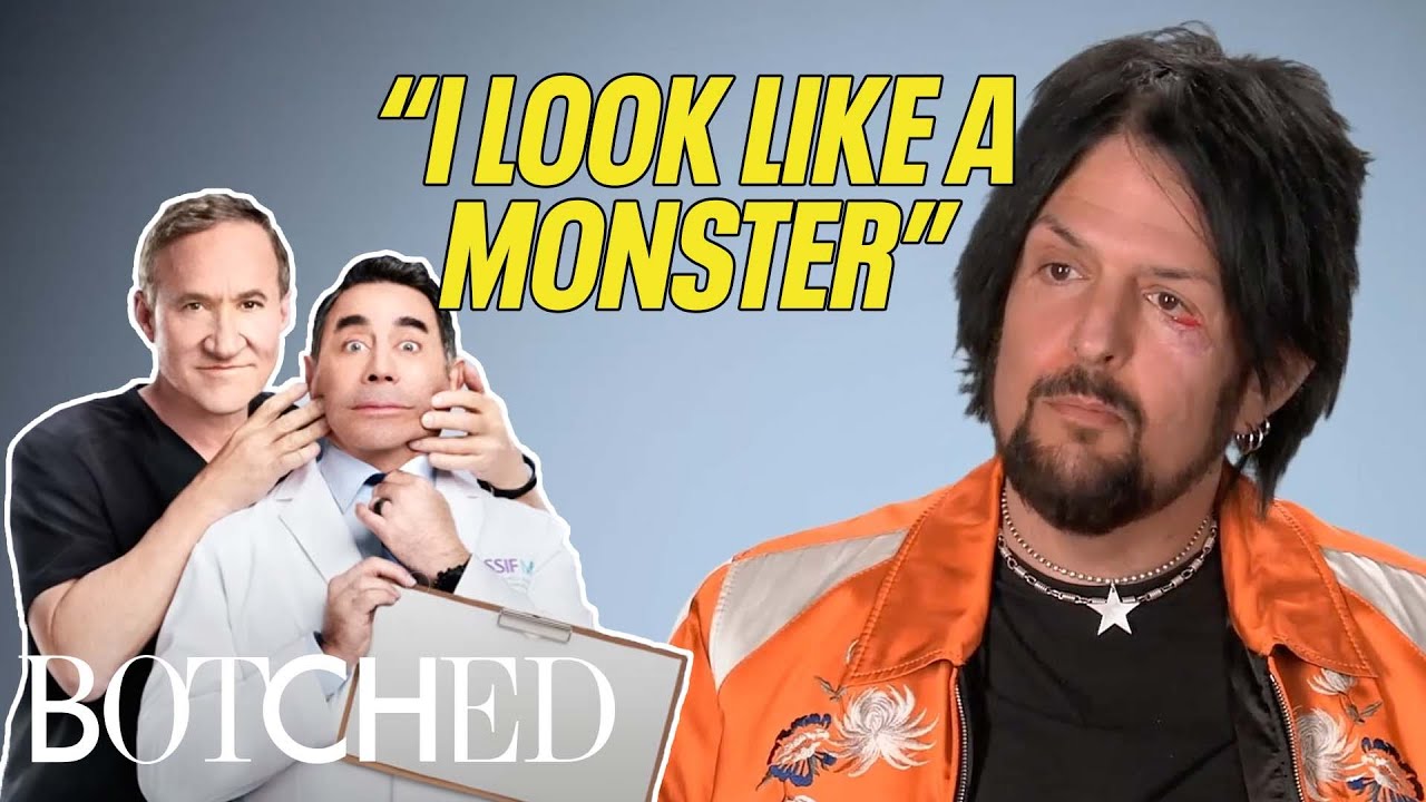Botched FACE PROCEDURES That Are Difficult to Face | Botched | E! - YouTube