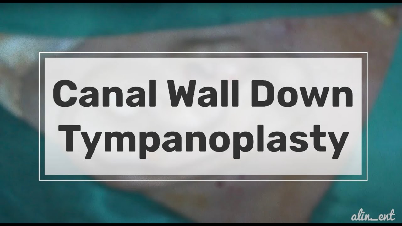 Canal Wall Down Tympanoplasty - YouTube