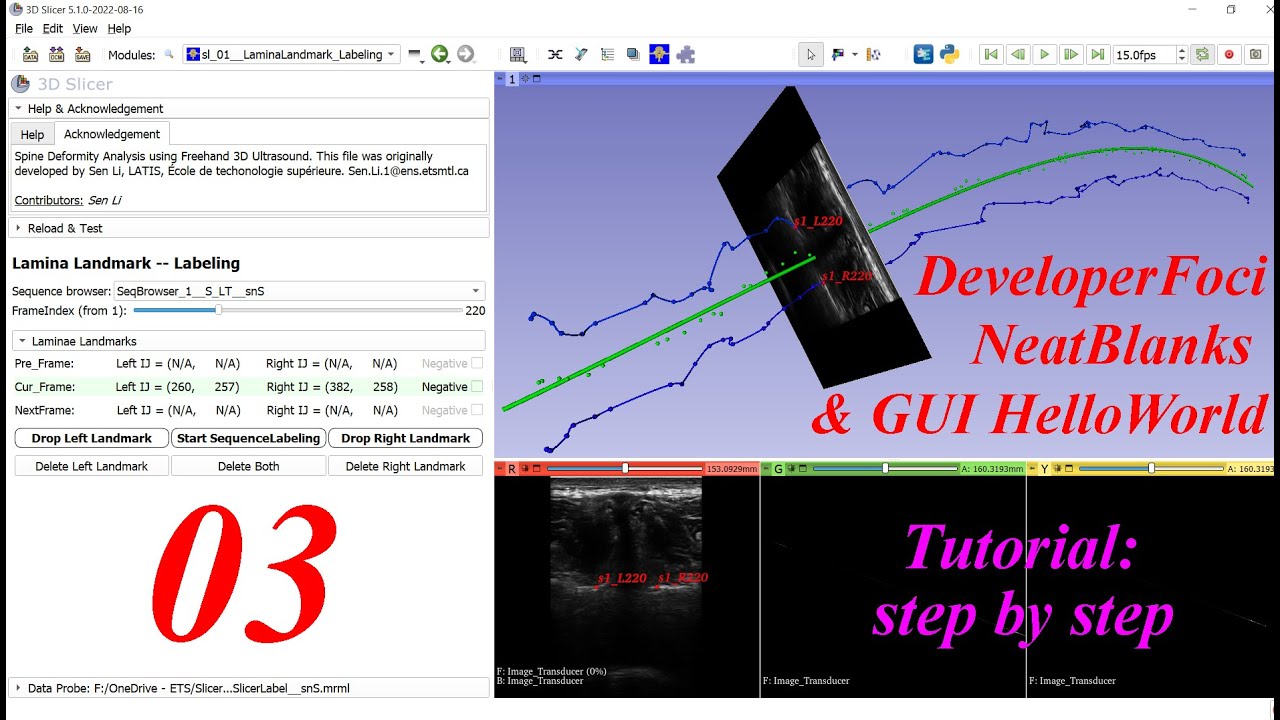 Developer / Slicer Area, Neat Blanks, GUI HelloWorld -- 3D Slicer ...