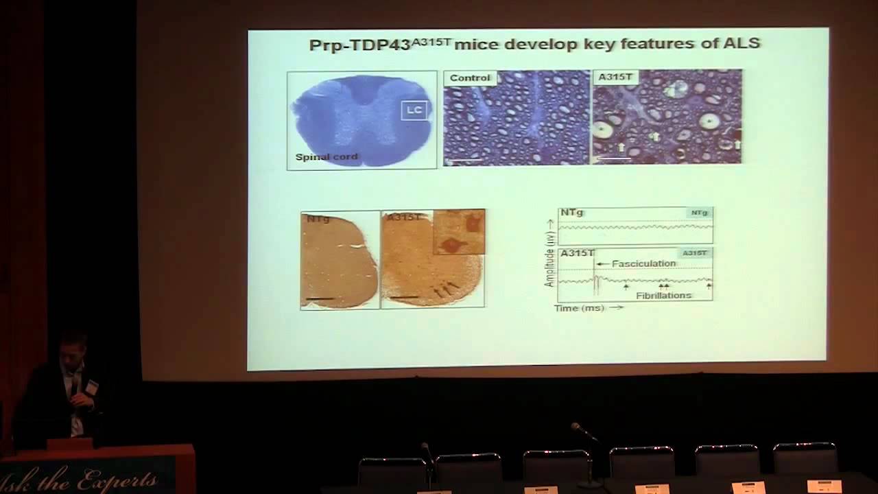 2011-"Ask the Experts-'Living with ALS" at UCLA--Dr. Robert Baloh - YouTube