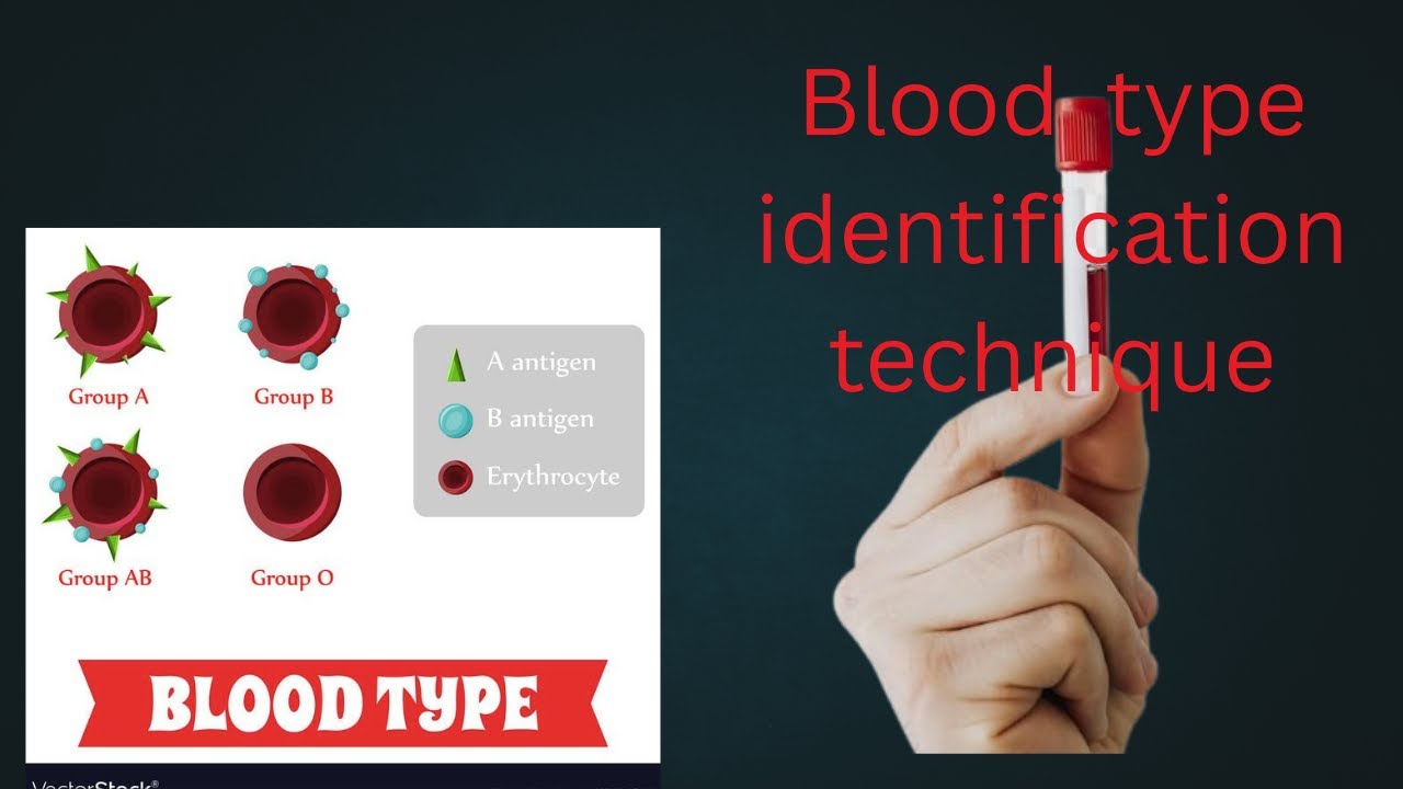 የደም አይነታችንን የምንለይበት መንገድ /Blood type identification technique - YouTube