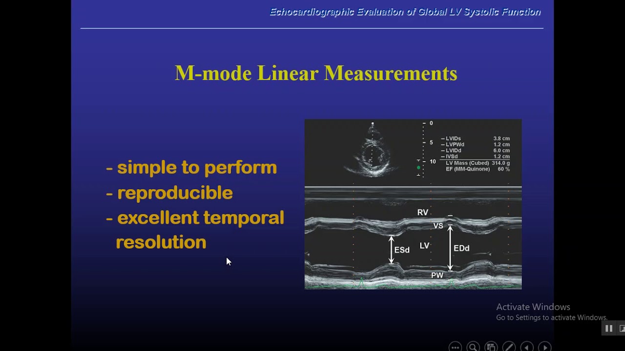 Assessment of systolic function - Dr Azza Farrag - YouTube