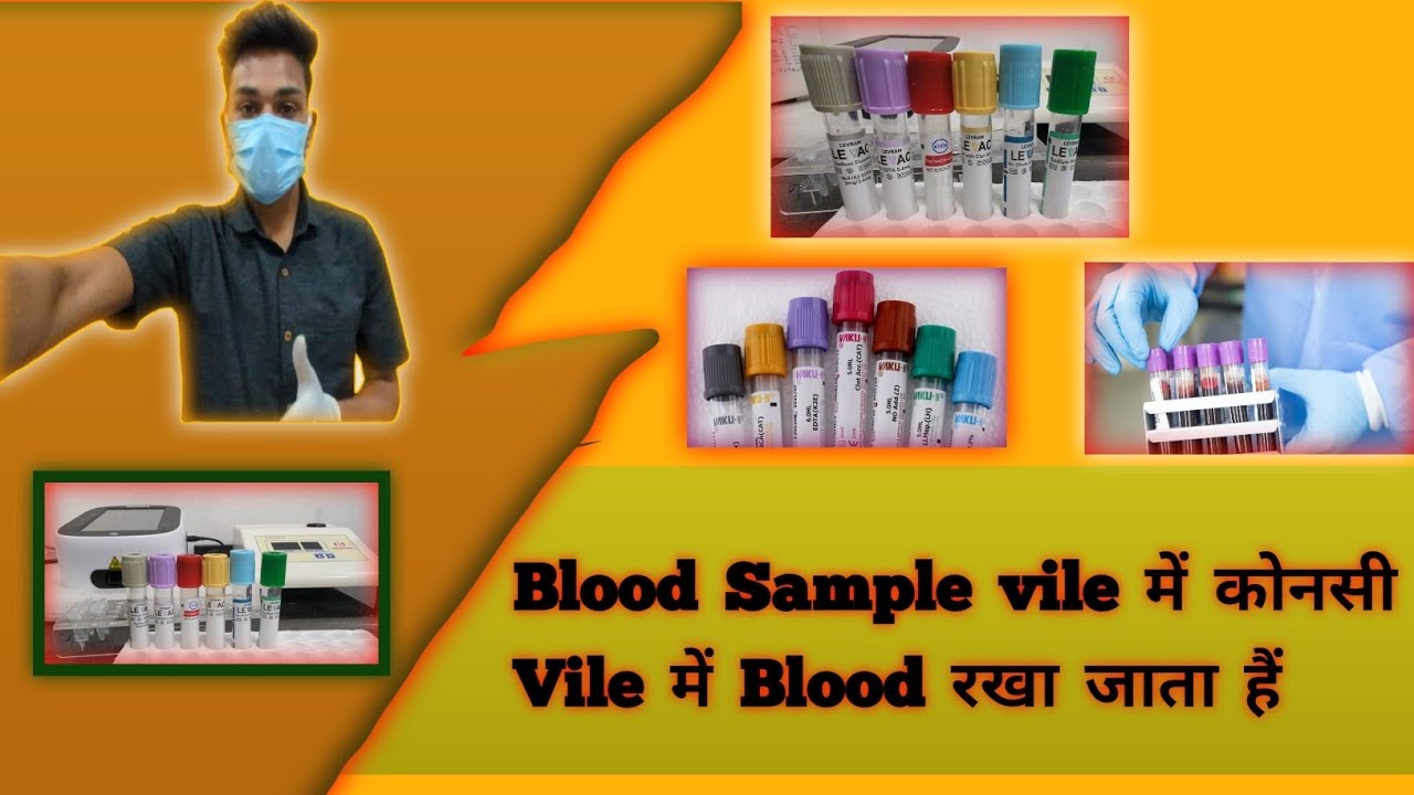 BLOOD SAMPLE KON SE VILE ME RAKHA JATA H।। और कोन सा vile किस use के ...
