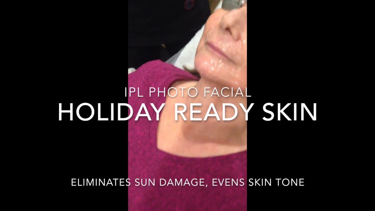 IPL Holiday Ready Skin - Results May Vary - YouTube