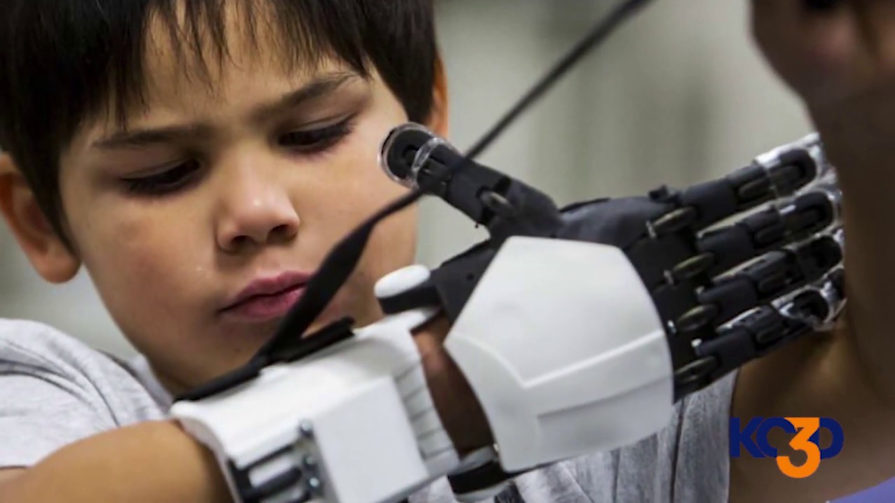 KC3D Enable Project - 3D Printed Hand - YouTube