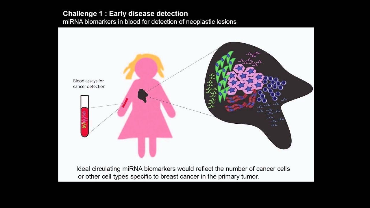 microRNAs in breast cancer – Video Abstract [ID 43799] - YouTube