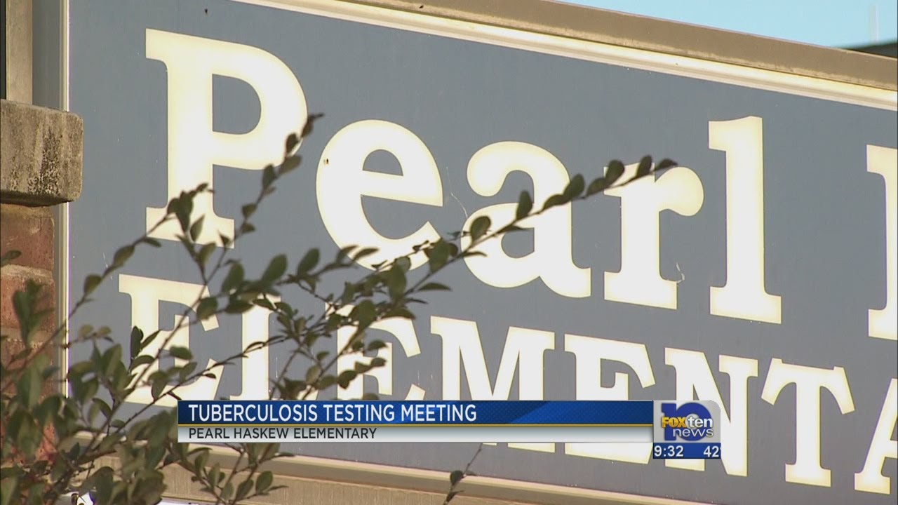 Pearl Haskew parents to learn more about tuberculosis tests - YouTube