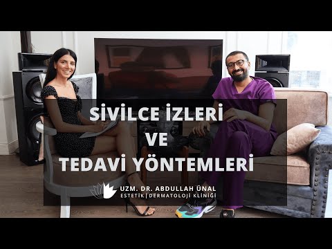 Sivilce İzi Tedavisi Nasıl yapılır?