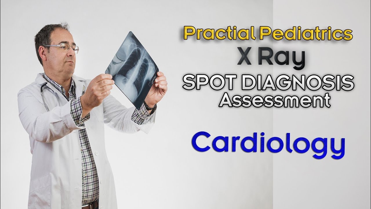 Pediatrics Radiology - Cardiology X ray Spots - YouTube