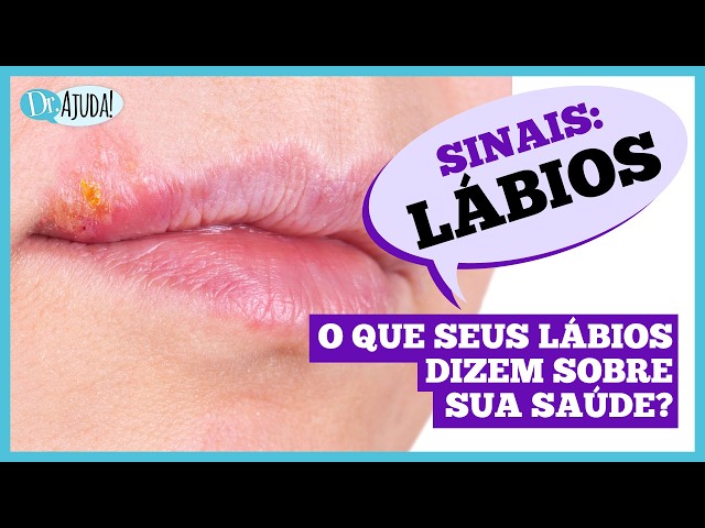 Herpes Dentro Dos Labios Enfermedades Víricas Y Bacterianas De La